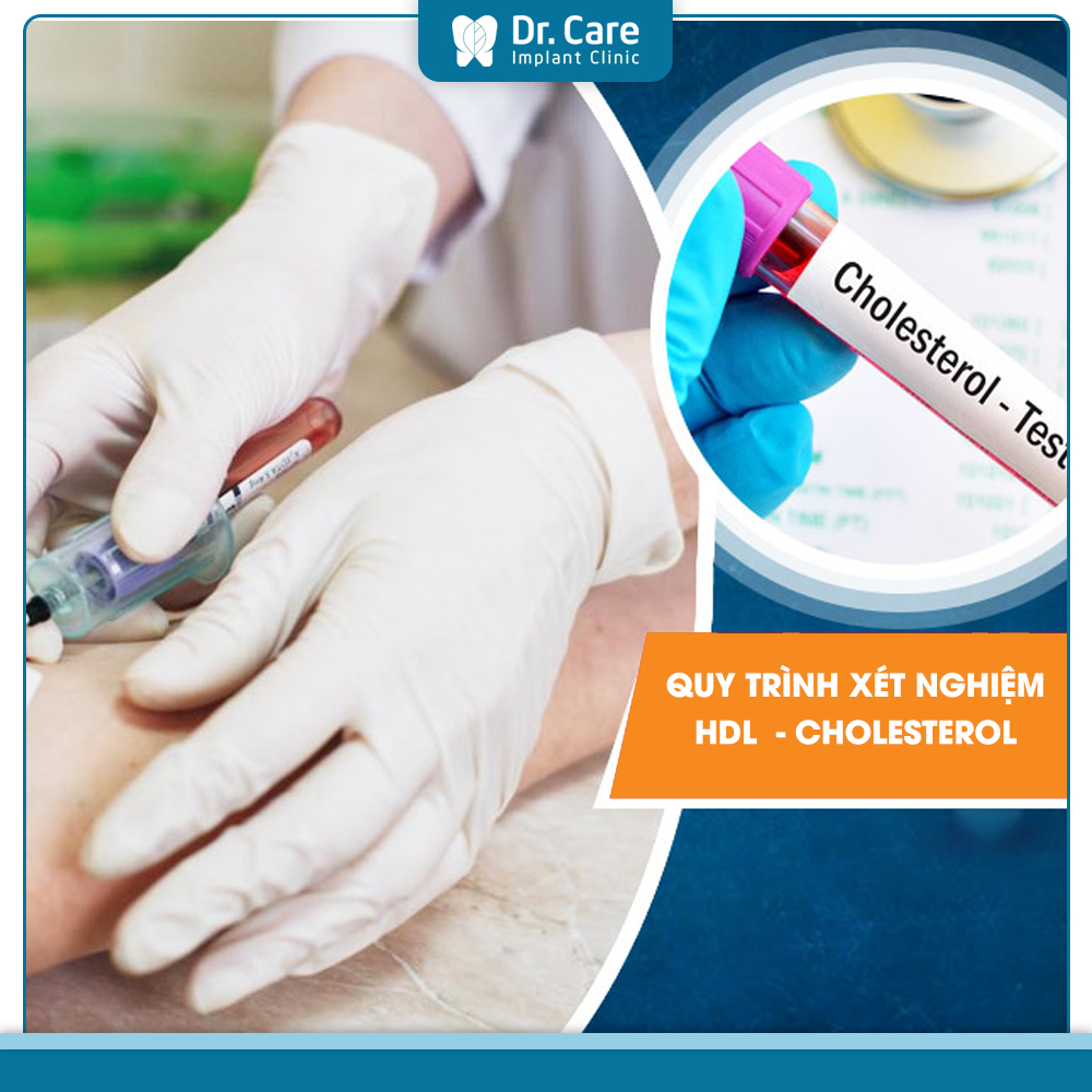 Hdl Cholesterol Là Gì Những Thông Tin Nên Biết Về Hdl Cholesterol